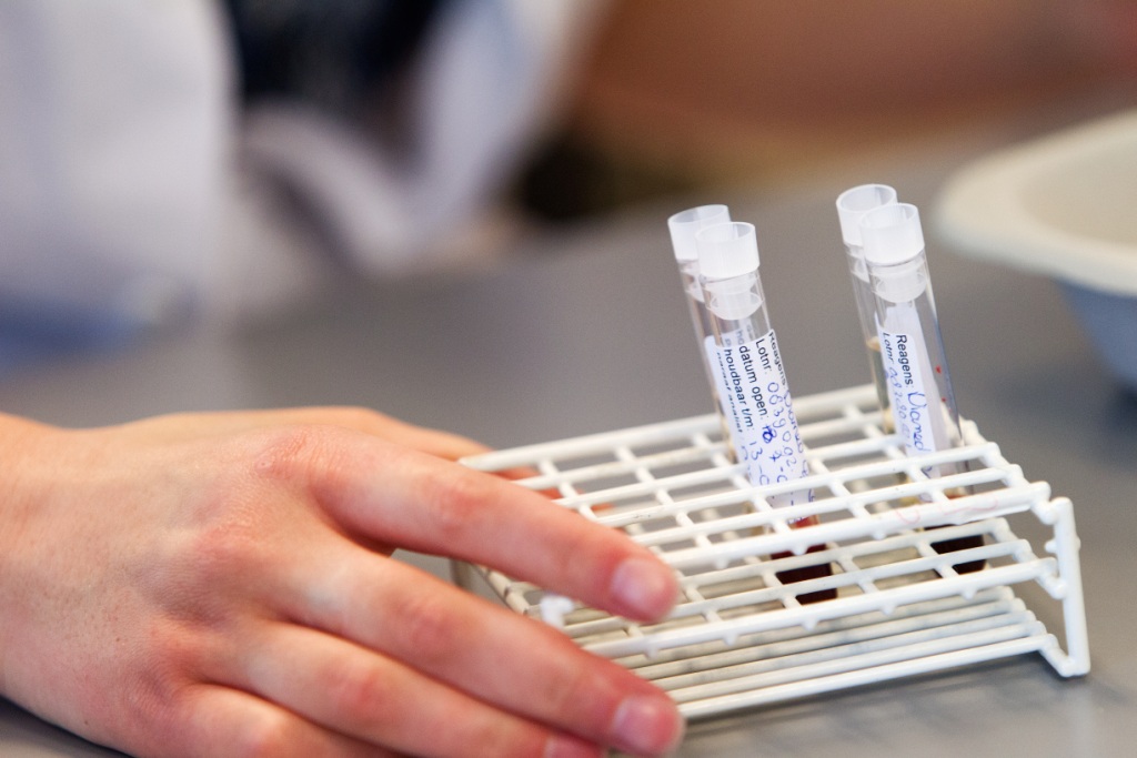 Evaluatie van de huidige frequentie van lange-termijn DMARD lab controles